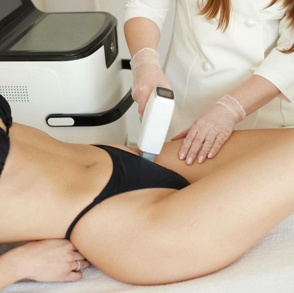 Epilasyon Laser Milasha, Moskova, foto