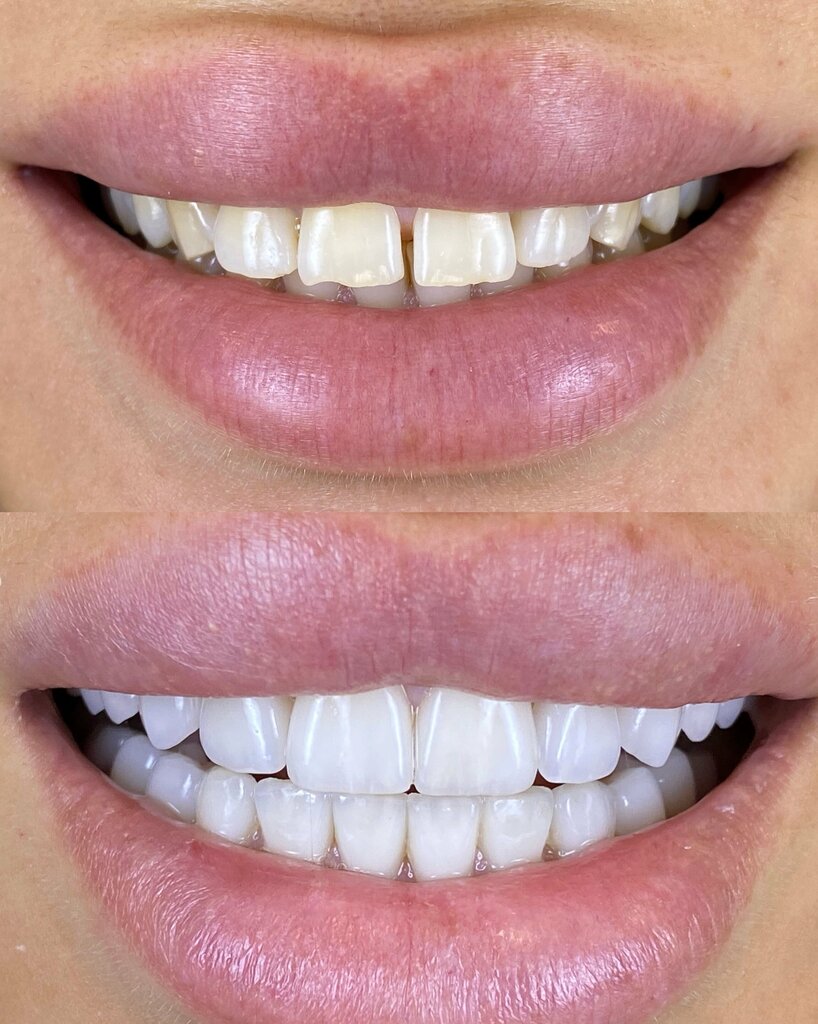 Özel ağız ve diş sağlığı klinikleri ve muayenehaneleri Smile, Moskova, foto