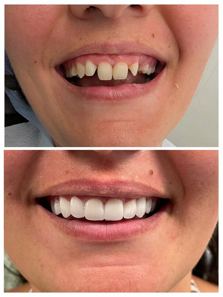 Özel ağız ve diş sağlığı klinikleri ve muayenehaneleri Klinika Dentale ParaDent Prishtine, Priştina, foto