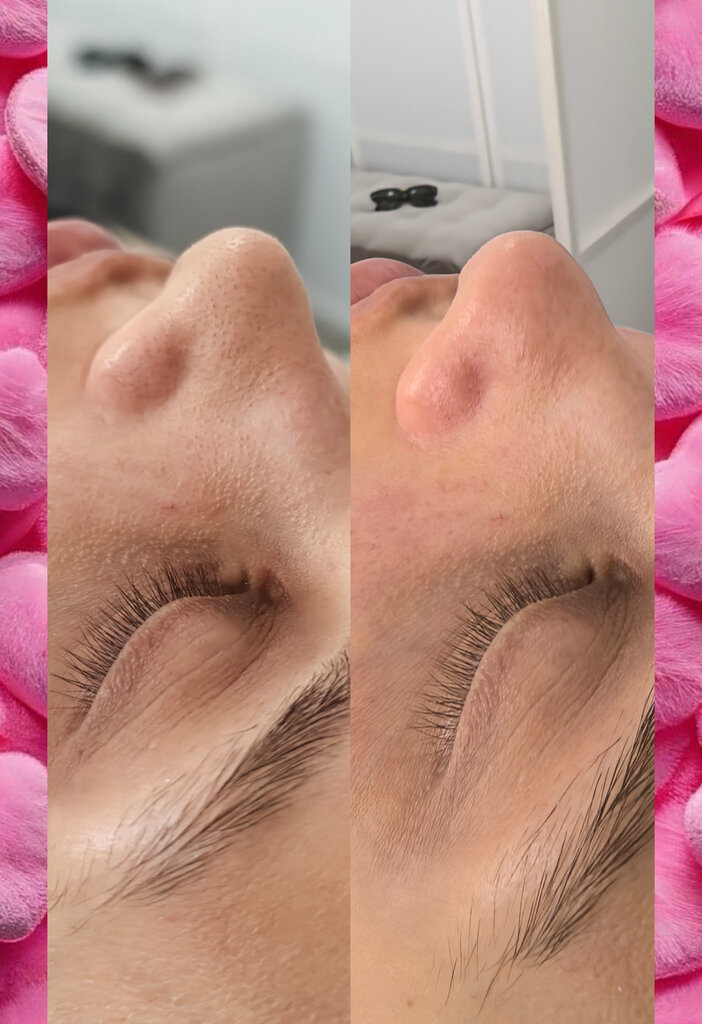 Kozmetoloji, kozmetik salonları Anlina Cosmetology, Moskova, foto