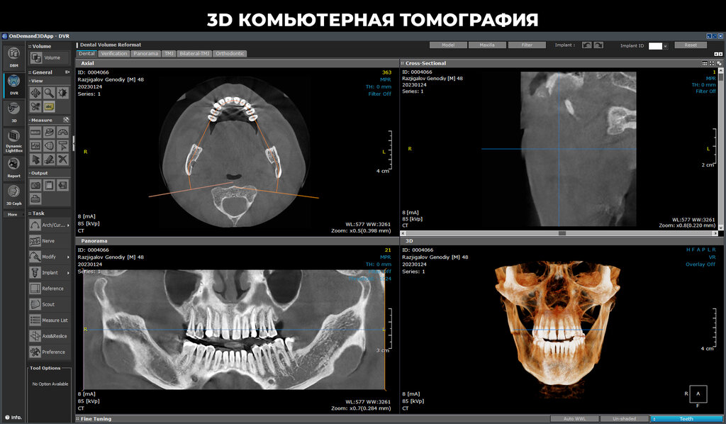 Endüstriyel güvenlik denetimi 3D Rentgen, Buhara, foto