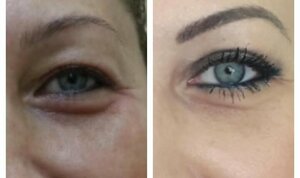 Surgimed (ulitsa Kalmykova No:18), tıp merkezleri ve klinikler  Nalchik'ten