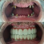 Diş Hekimi Yakup Tal (Elazığ, Elazığ Merkez , Hacı Tevfik Efendi Sok., 12/1), hastaneler  Elazığ'dan