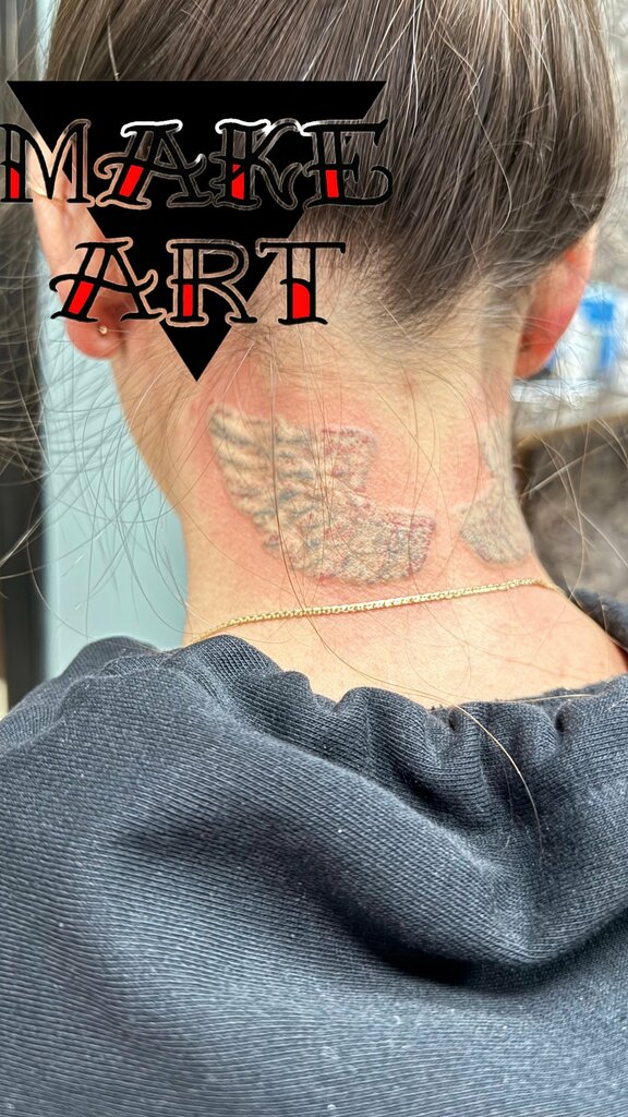 Dövmeciler Лазерное удаление тату татуажа, Tiumen, foto