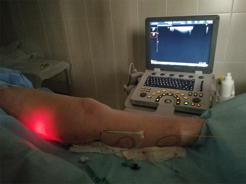 Hastaneler Phlebological Center and Vascular Surgery, Moskova, foto