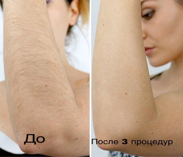 Kozmetoloji, kozmetik salonları AngelinaLab, Mytişçi, foto