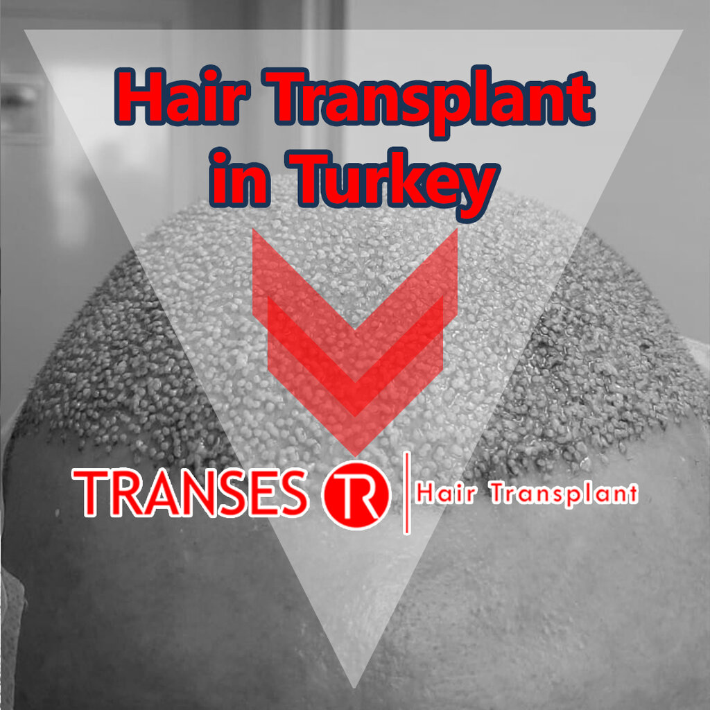 Tıp merkezleri ve klinikler Transes Saç Ekim Merkezi, İstanbul, foto