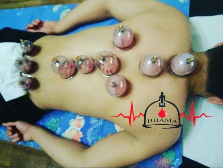 Alternatif tıp merkezleri Imam Hijama, Adıge Cumhuriyeti, foto
