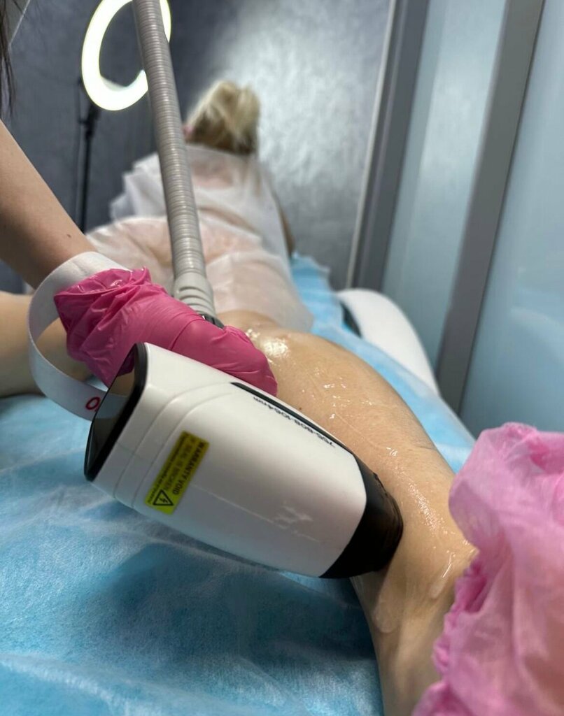 Epilasyon Epilaser_pro, Moskova ve Moskovskaya oblastı, foto