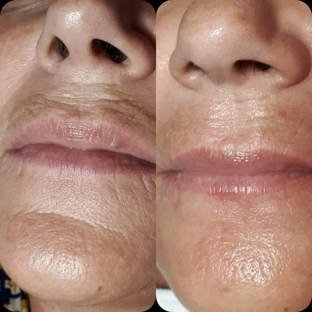 Tıp merkezleri ve klinikler Nani Martínez estética y quiromasaje, Galisya, foto