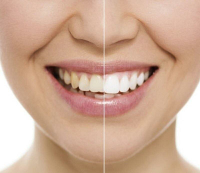 Özel ağız ve diş sağlığı klinikleri ve muayenehaneleri Studio Dentistico Dennis Ventrice, Trieste, foto