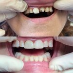 Studio Dentistico Barone Dr. Giuseppe (Piazza Pia No:28, Anzio), özel ağız ve diş sağlığı klinikleri ve muayenehaneleri  Anzio'dan