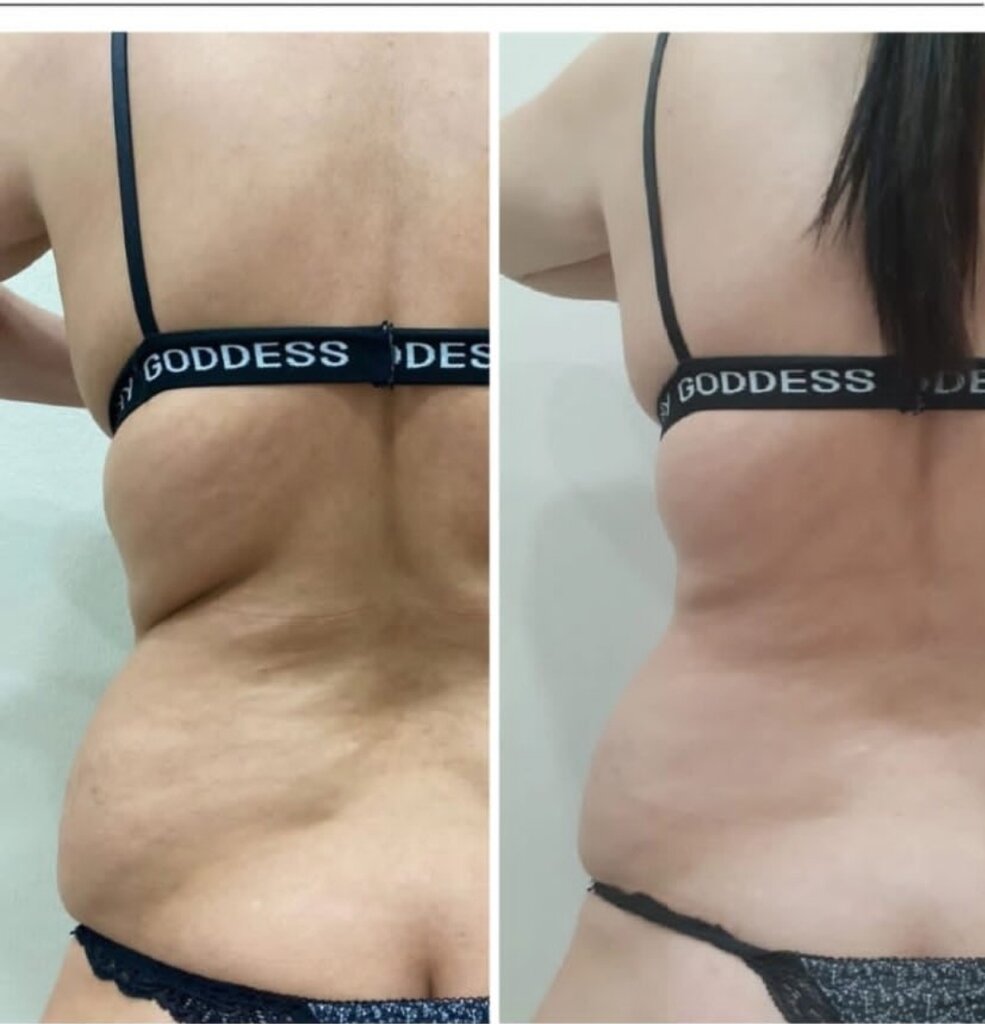 Masaj salonları Linea Perfecta, Moskova, foto