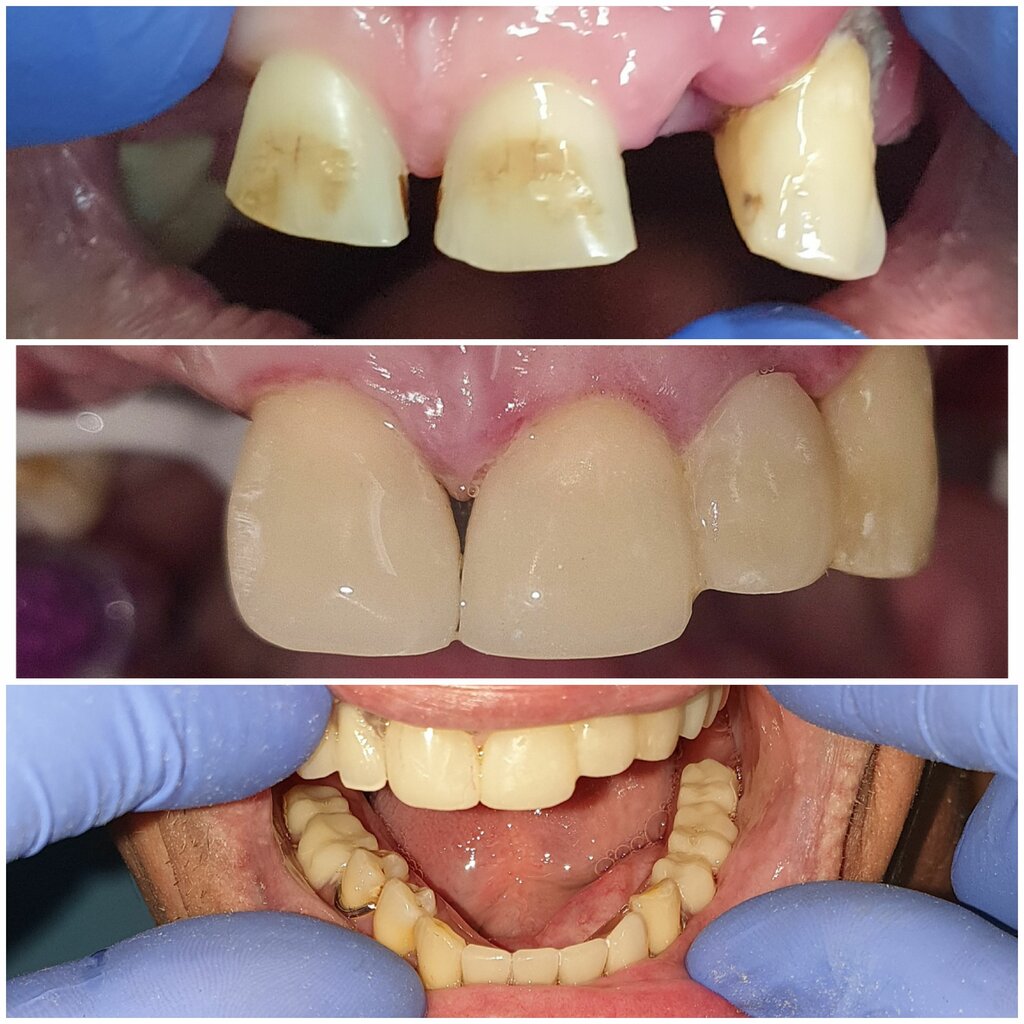 Özel ağız ve diş sağlığı klinikleri ve muayenehaneleri Iva-Dent Stomatologichesky tsentr ChUP po Okazaniyu Uslug Iva, Baranavichy, foto