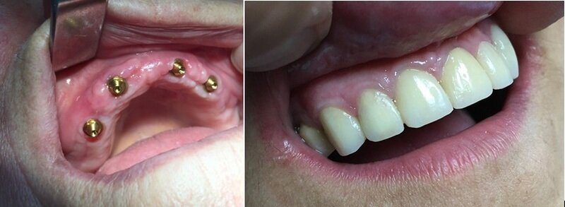 Plastik cerrahi klinikleri Studio Odontoiatrico Dr. Canepa, Alessandria, foto