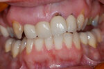Dr méd. dent. Tétaz Luc (Avenue de la Gare No:17, Lausanne), özel ağız ve diş sağlığı klinikleri ve muayenehaneleri  Lozan'dan