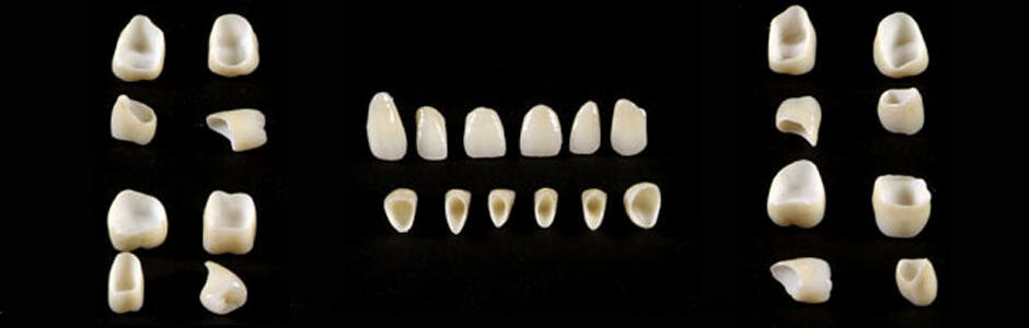 Özel ağız ve diş sağlığı klinikleri ve muayenehaneleri Clínica Dental Siqués, Girona, foto