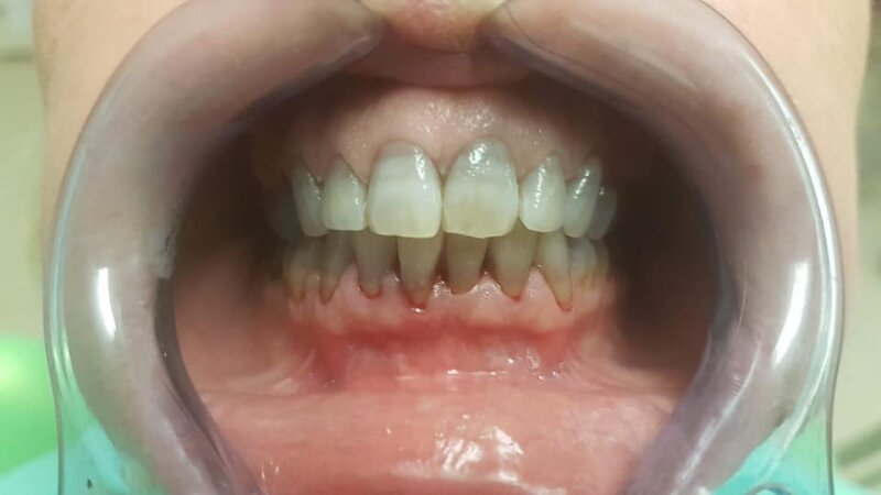 Özel ağız ve diş sağlığı klinikleri ve muayenehaneleri Studio Medico Dentistico Maggio Dr. Marco, Sicilya, foto
