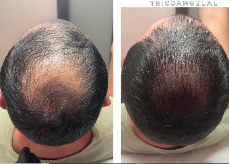 Sağlık merkezleri Linfa Vitale Estetica e Massaggi, Cuneo, foto