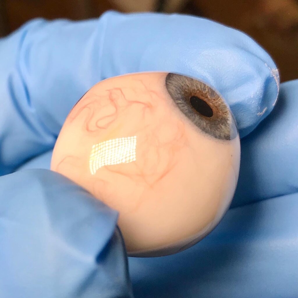 Ortopedik ürünler Ocular prosthetics laboratory Centrglazomsk, Omsk, foto