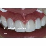 Estética Oral (Santander, Municipio de Bucaramanga, Carrera 33, 30A-75), özel ağız ve diş sağlığı klinikleri ve muayenehaneleri  Bucaramanga'dan