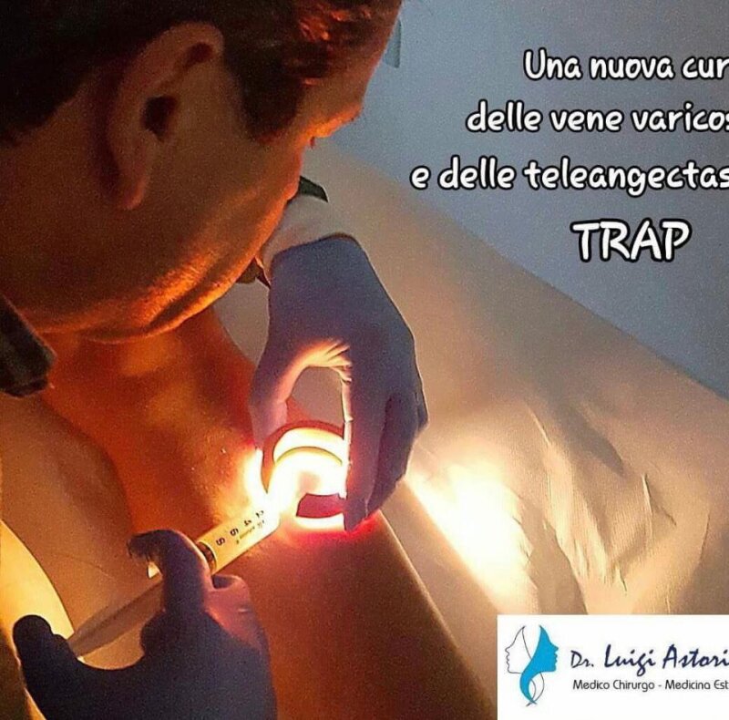 Plastik cerrahi klinikleri Astorino Dott. Luigi Medicina Estetica e Metodica Trap, Calabria, foto