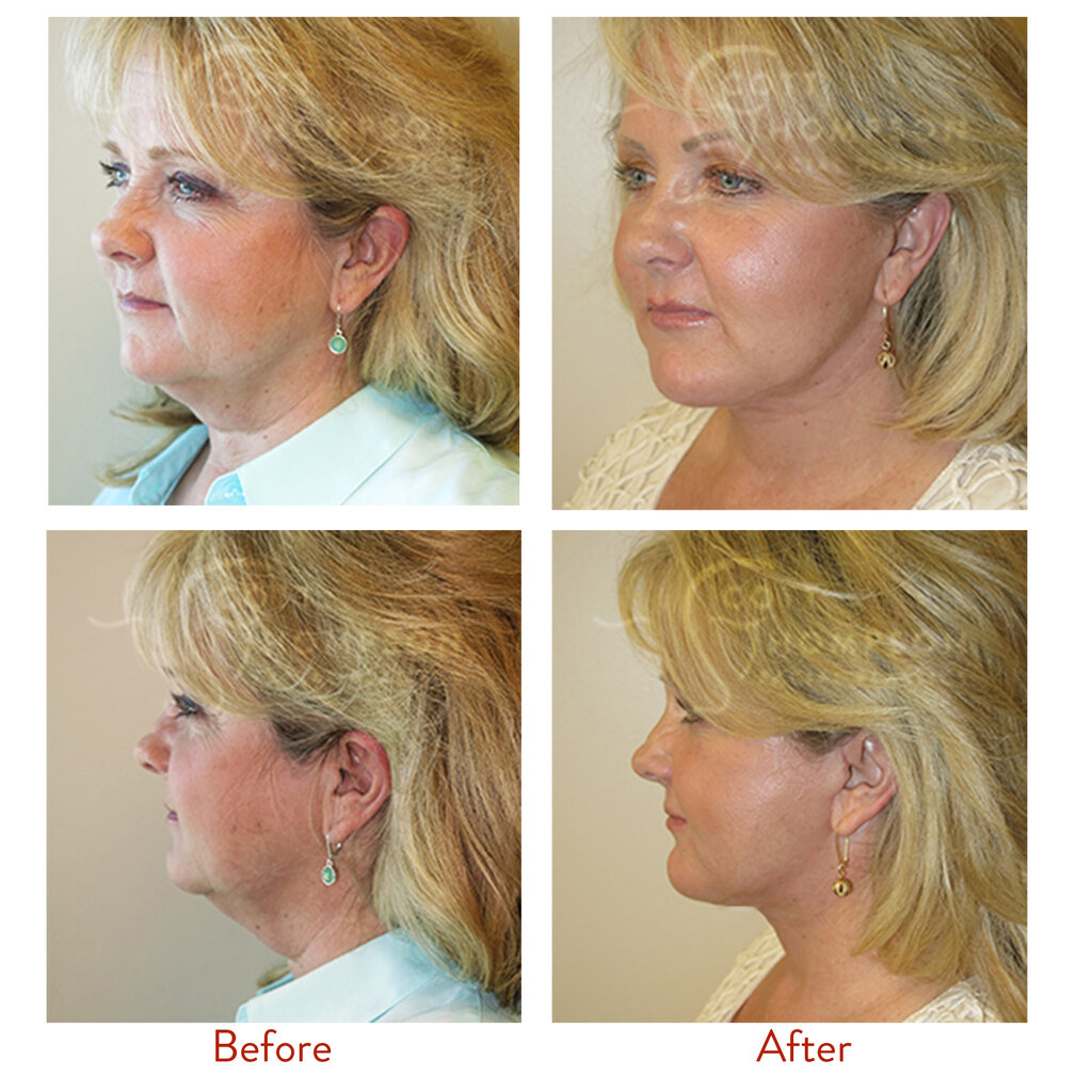 Spa Utah Facial Plastics & Ufp Aesthetics, Utah, foto