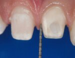 Studio Dentistico Prosper Dr. Loris (Via San Gottardo No:84, Monza), özel ağız ve diş sağlığı klinikleri ve muayenehaneleri  Monza'dan