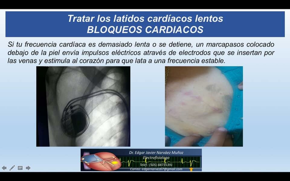 Hastaneler Dr. Edgar Javier Narvaez Muñoz, Managua, foto