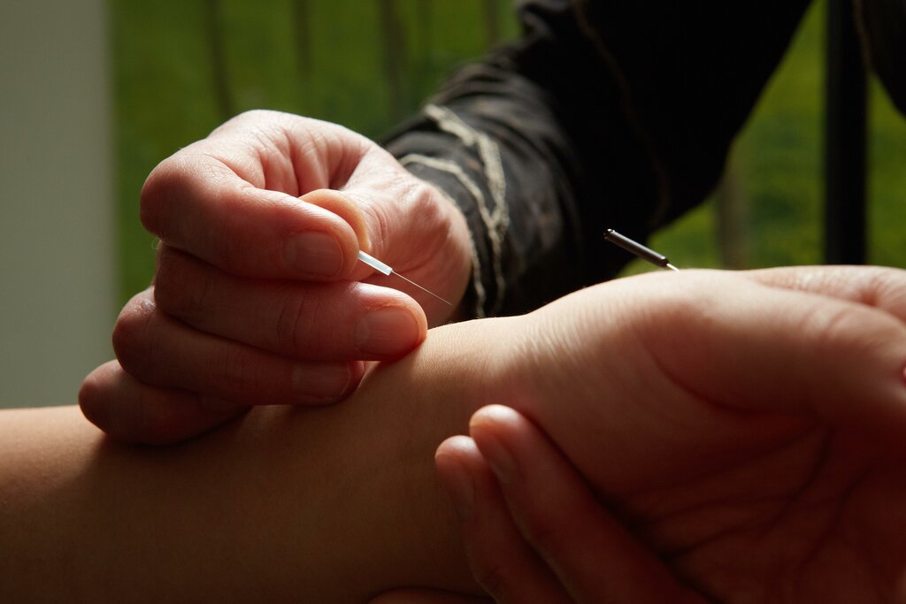Alternatif tıp merkezleri BeleefBalans Acupunctuur, Homeopathie & Hartcoherentie, , foto