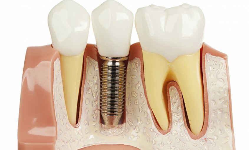 Özel ağız ve diş sağlığı klinikleri ve muayenehaneleri Clinica Dental Doctor Alberto Sastre, Murcia, foto