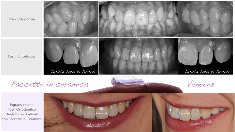 Özel ağız ve diş sağlığı klinikleri ve muayenehaneleri Studio Ortodontico Cocconi Rapa S. S., Parma, foto