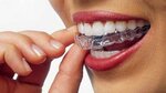 Mazzi Dr. Stefano - Studio Dentistico (Lombardy, Provincia di Milano, Via Monte Grappa, 13), medikal cihaz firmaları  Lombardiya'dan
