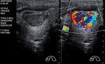 Studio di Radiologia Palumbo (Corso Campano No:134, Giugliano in Campania), tıbbi laboratuvarlar  Varcaturo'dan