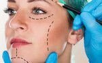 Paterlini Dr. Piero Medicina estetica e flebologia (Lombardy, Brescia, Via Passo del Sempione, 26), plastik cerrahi klinikleri  Lombardiya'dan