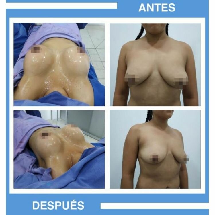 Tıp merkezleri ve klinikler Doctor Carlos Acevedo Espitia Cirujano Plastico, Bucaramanga, foto