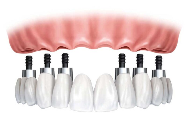 Plastik cerrahi klinikleri Studio Dentistico Dr. Lanni Daniele, Toskana, foto