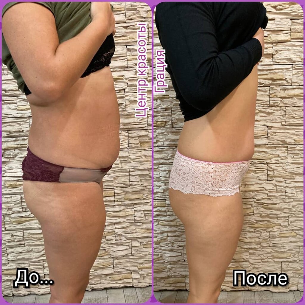 Spa Grace, Tver, foto