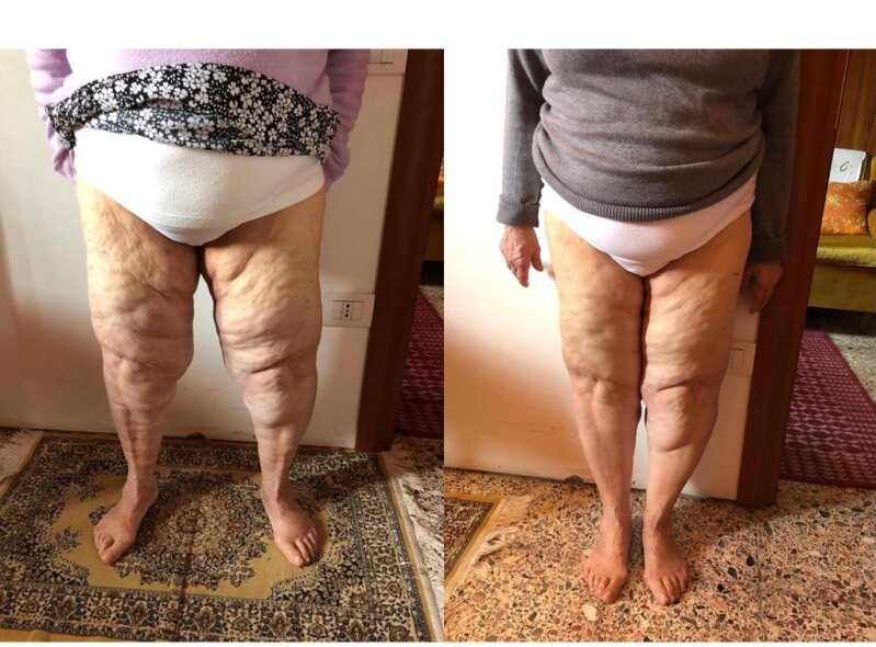 Tıp merkezleri ve klinikler Schirru Paolo Fisioterapia e Riabilitazione Flebo-Linfatica, Sardunya, foto