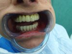 Studio Dentistico Zuccarino dott. Stefano (Via Gabriele Jannelli No:16, Naples), plastik cerrahi klinikleri  Napoli'den