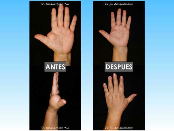 Ortopedik ürünler Baja Hand Clinic Dr Jose Luis Aguilar, Tijuana, foto