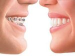 Studio Dentistico Bove Dr. Antonio (Campania, Salerno, Nocera Inferiore), özel ağız ve diş sağlığı klinikleri ve muayenehaneleri  Campania'dan