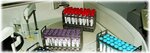 Laboratorio Analisi Bidiesse (Via Fosse Ardeatine No:9, Perugia, Chiugiana-La Commenda), tıbbi laboratuvarlar  Umbria'dan