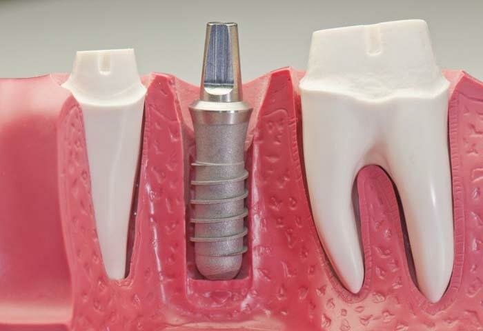 Özel ağız ve diş sağlığı klinikleri ve muayenehaneleri Studio Dentistico Brigliadori, Lombardiya, foto