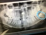 Centro Odontoiatrico Saldent (Via Uberti No:15, Abbiategrasso, Vigevano), özel ağız ve diş sağlığı klinikleri ve muayenehaneleri  Lombardiya'dan