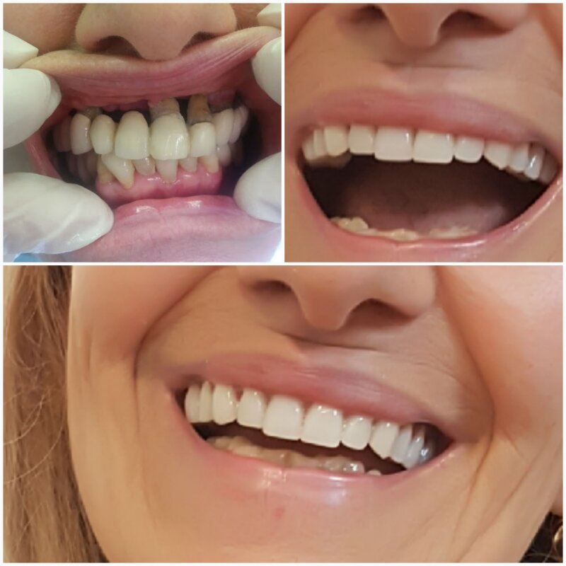 Özel ağız ve diş sağlığı klinikleri ve muayenehaneleri Studio Dentistico Novadent, Lombardiya, foto
