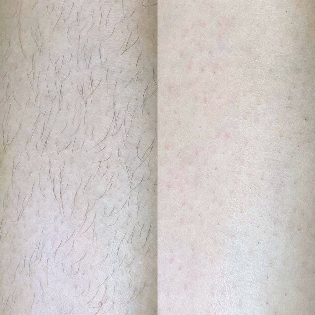 Güzellik salonu Epil, Bataysk, foto