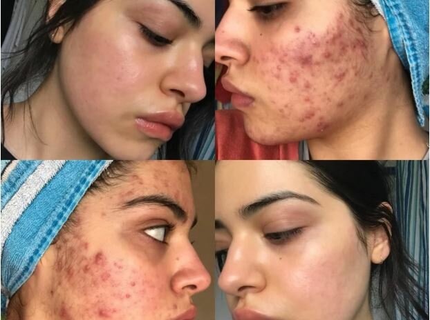 Spa Marina Skin Care, Kaliforniya Eyaleti, foto