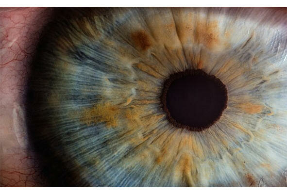 Optik cihazlar ve ekipmanlar Oculista Testoni Dr. Luigi, Sardunya, foto
