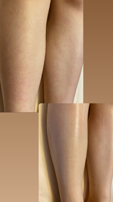 Epilasyon Elilab_sugar, Moskova, foto